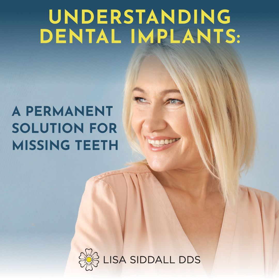 Understanding Dental Implants. Missing Teeth in Lake Leelanau, MI